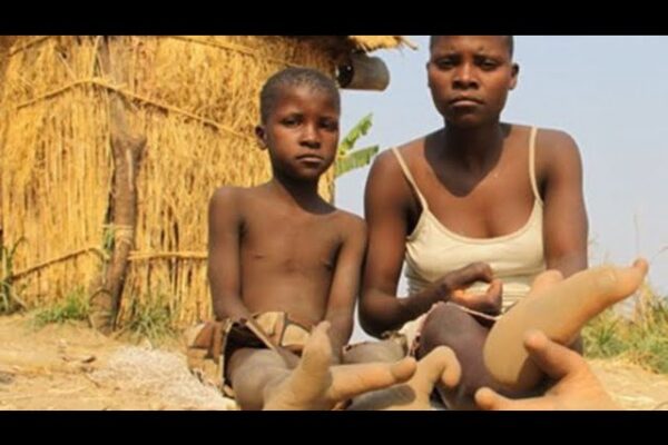 The Vadoma People: Facts, Feet, Hands, And Tribe Location.