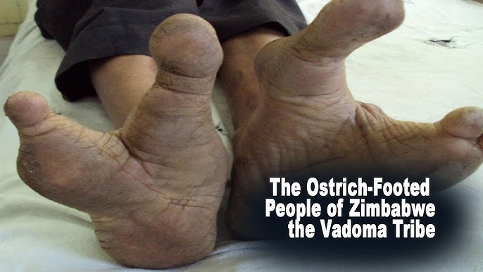 The Vadoma People: Facts, Feet, Hands, And Tribe Location.